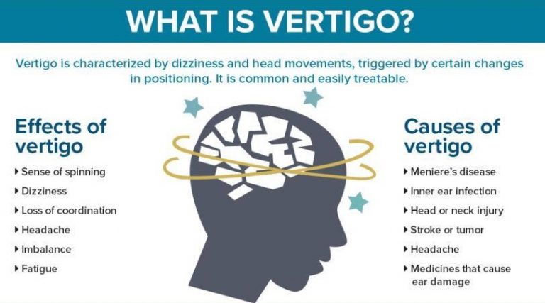 What is Vertigo? – Lucent Biotech